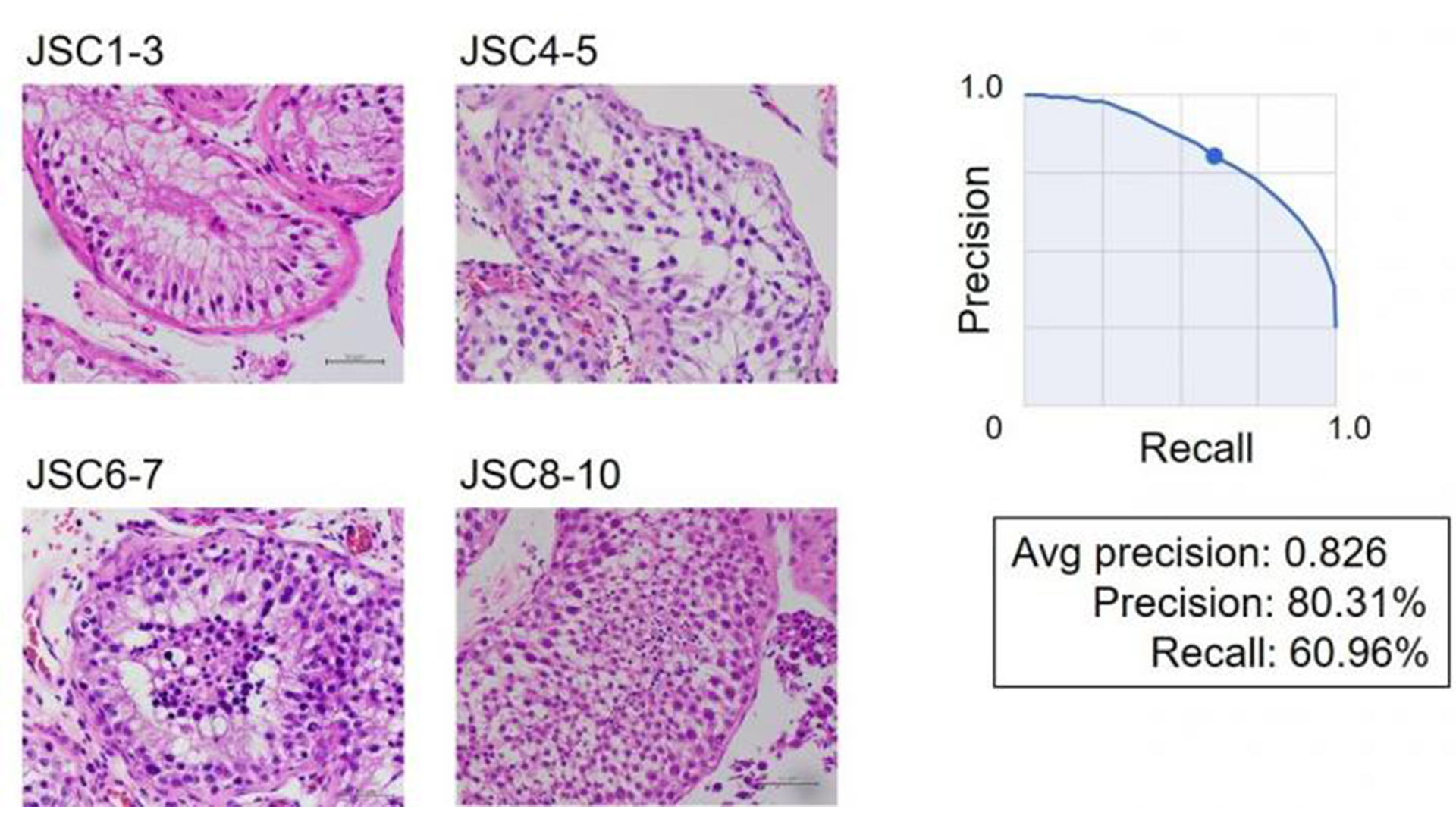 Male infertility scoring using AI-assisted image classification ...