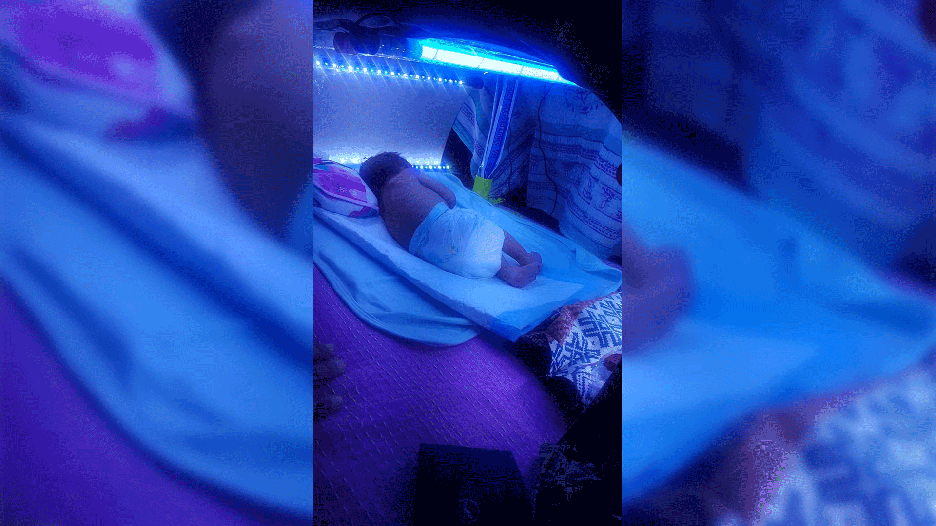 Home-built phototherapy saved an infant’s life - Healthcare Radius