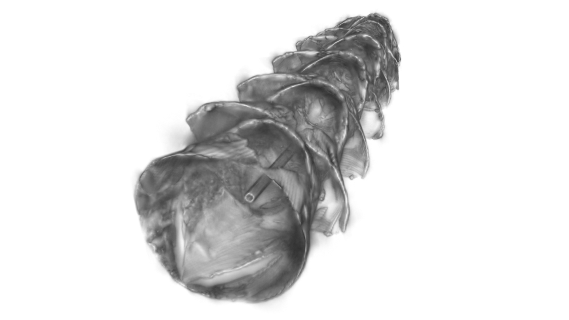 Stents inspired by paper-cutting art can deliver drugs to the GI tract ...