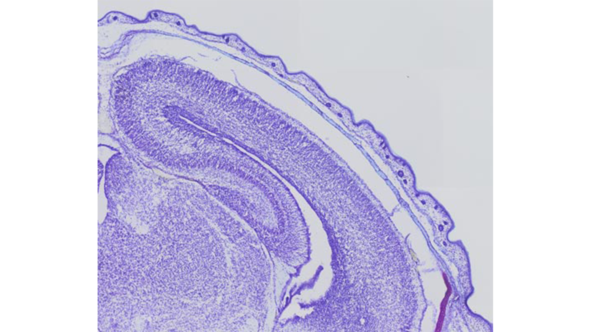 Defective gene slows down brain cells - Healthcare Radius