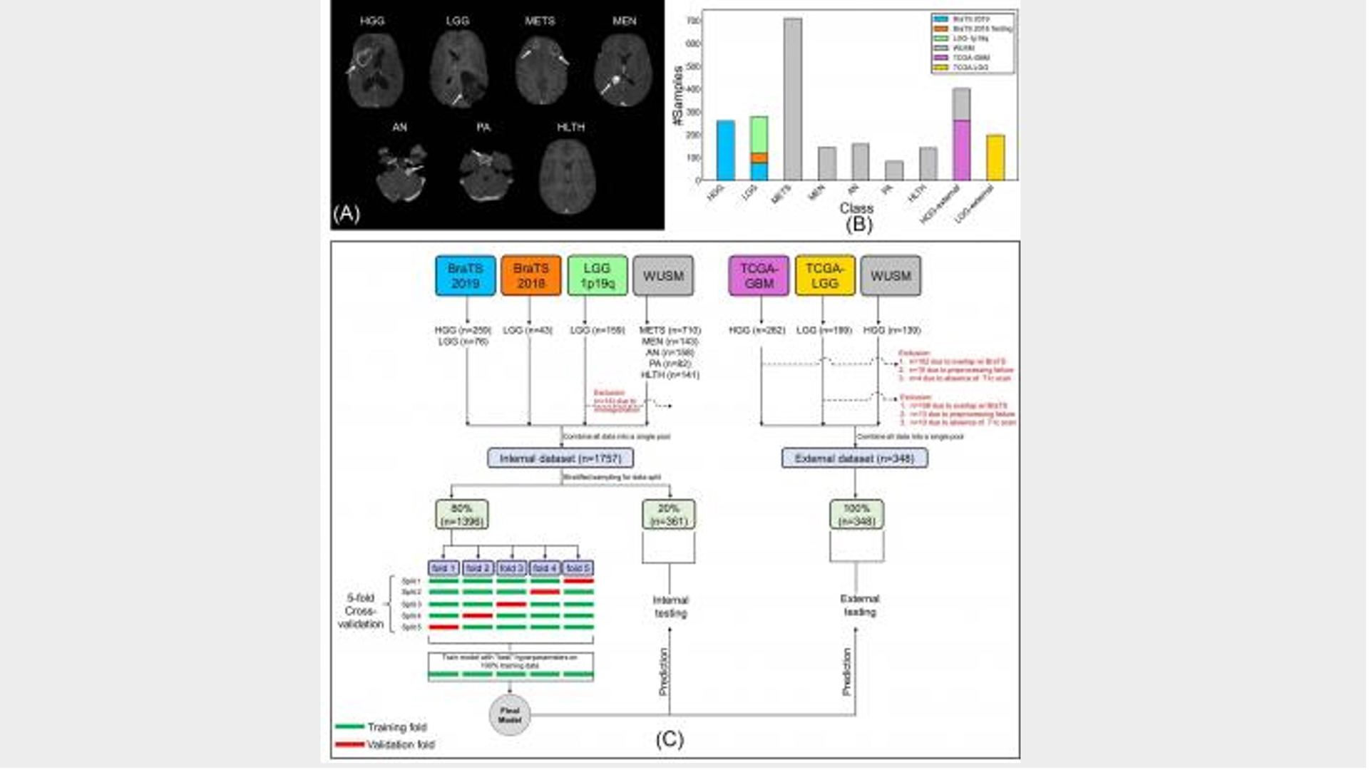 Deep Learning model classifies brain tumours with a single MRI scan ...