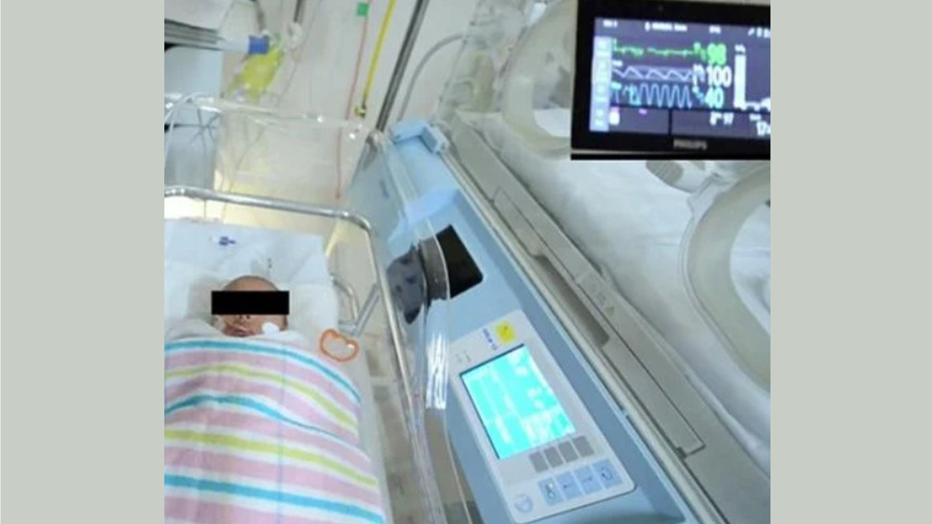 Noncontact ECG monitoring a step closer for neonatal wards - Healthcare ...