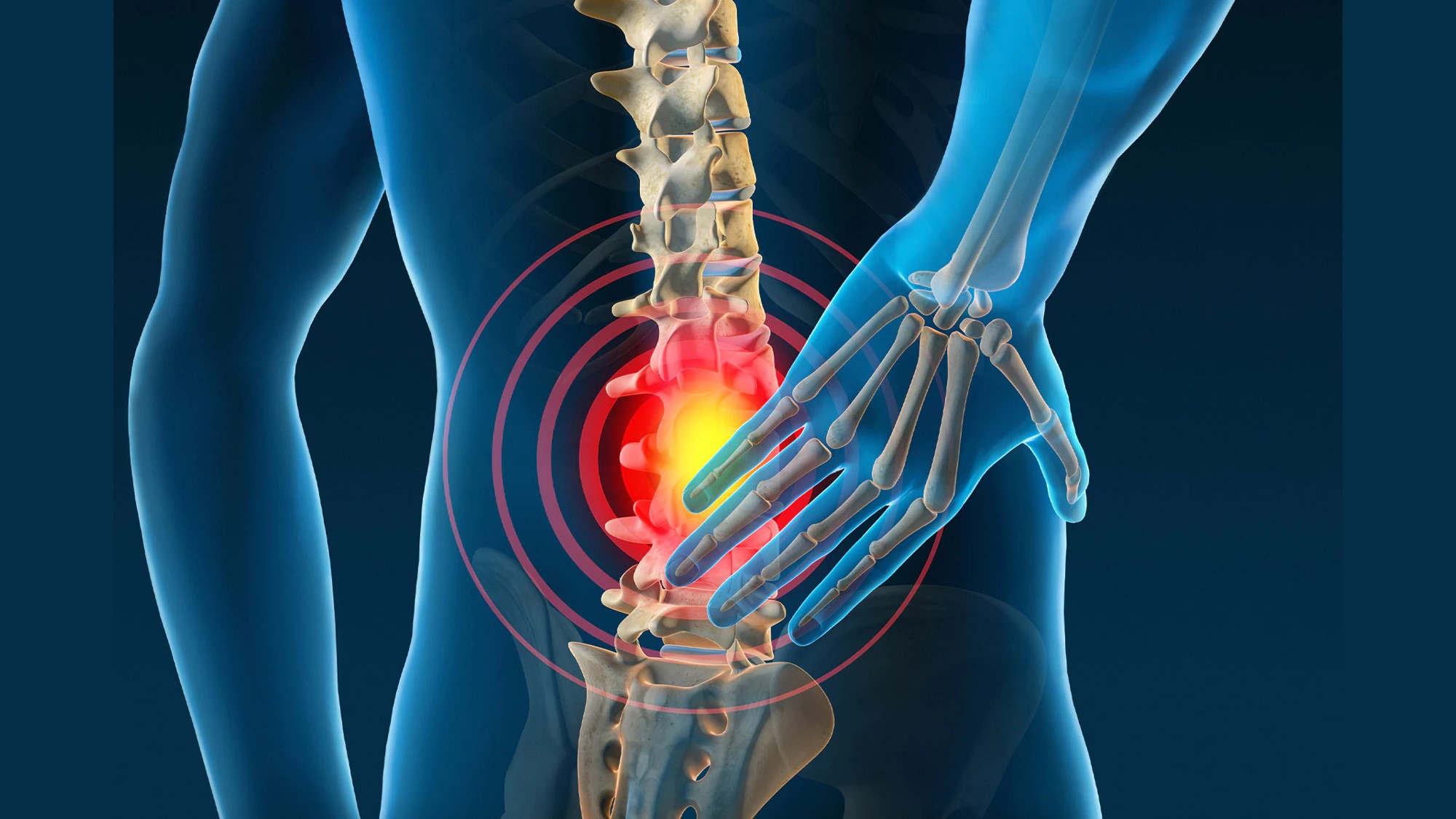 Bone & back problems on rise among millennial due to WFH - Healthcare ...