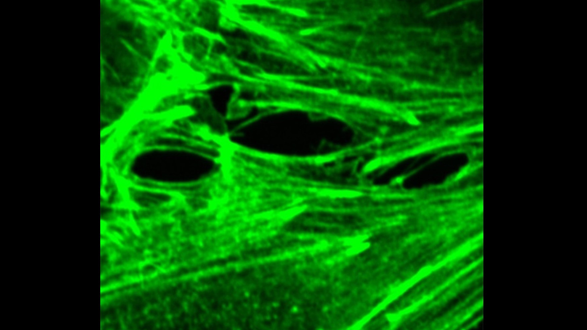 Researchers uncover the culprit behind leaky blood vessels from sepsis ...