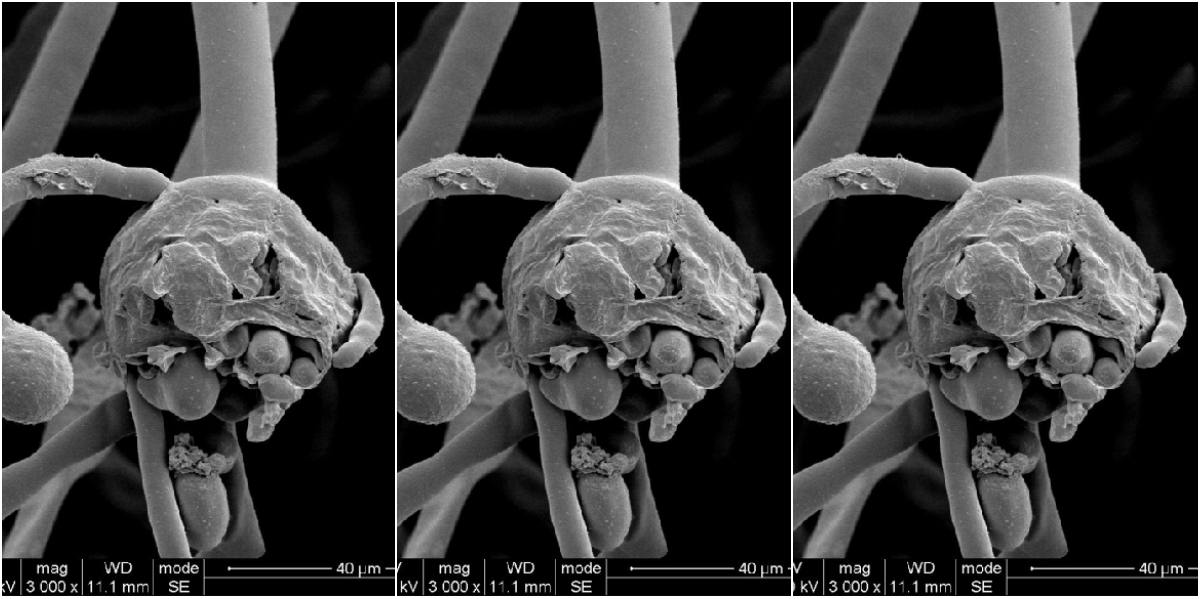 MaxiVision Eye Hospitals launches Mucormycosis early detection centre ...