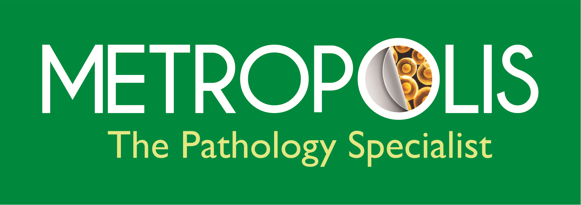 Metropolis Healthcare launches immunity check test ‘COVIPROTECT ...