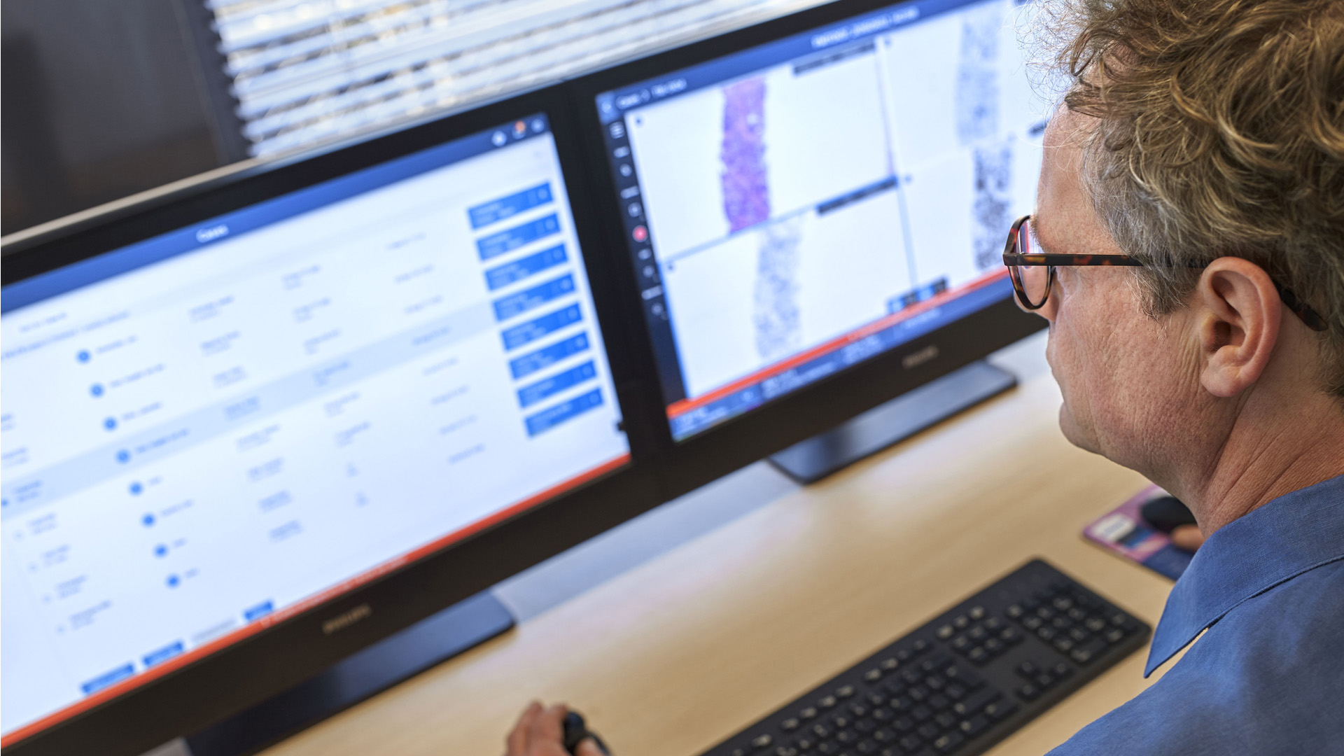 Philips introduces next-generation Digital Pathology Suite ...