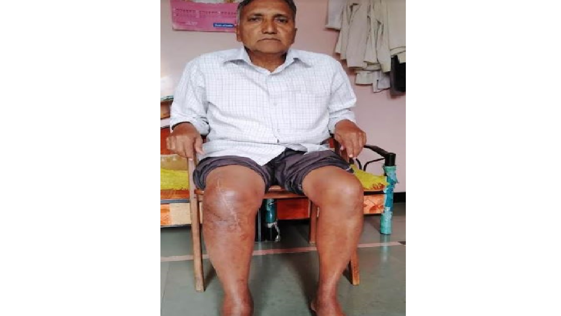 SaiShree Hospital first in Maharashtra to perform surgery using ...