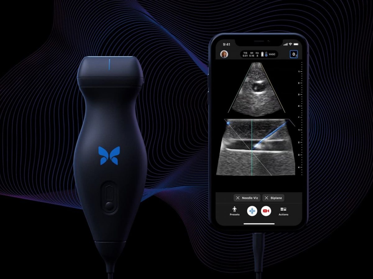 MIT Jameel Clinic’s Sybil AI tool predicts lung cancer risk ...