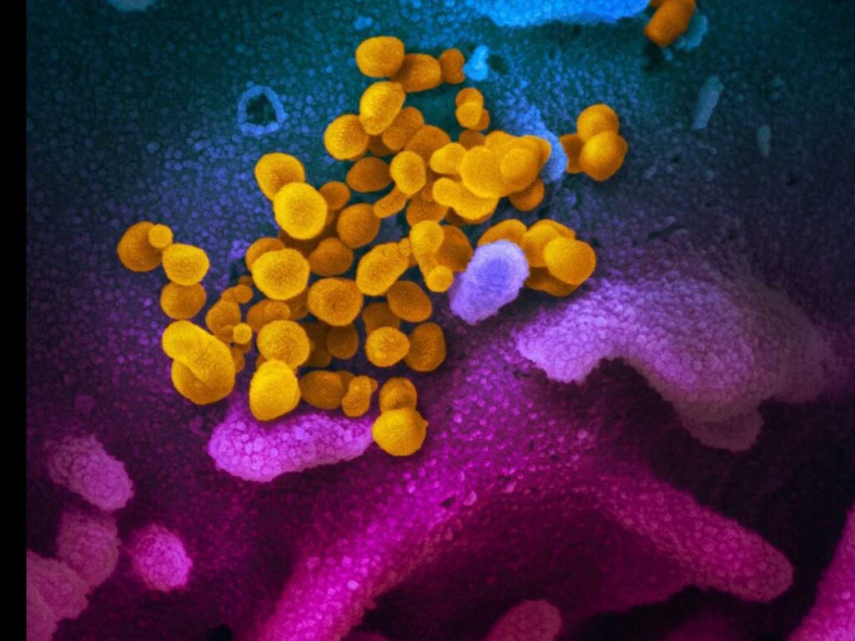 Tonix Pharmaceuticals begins subject enrolment in skin test trial ...