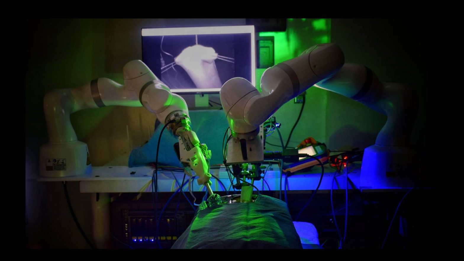 Robot performs first laparoscopic surgery without human help ...