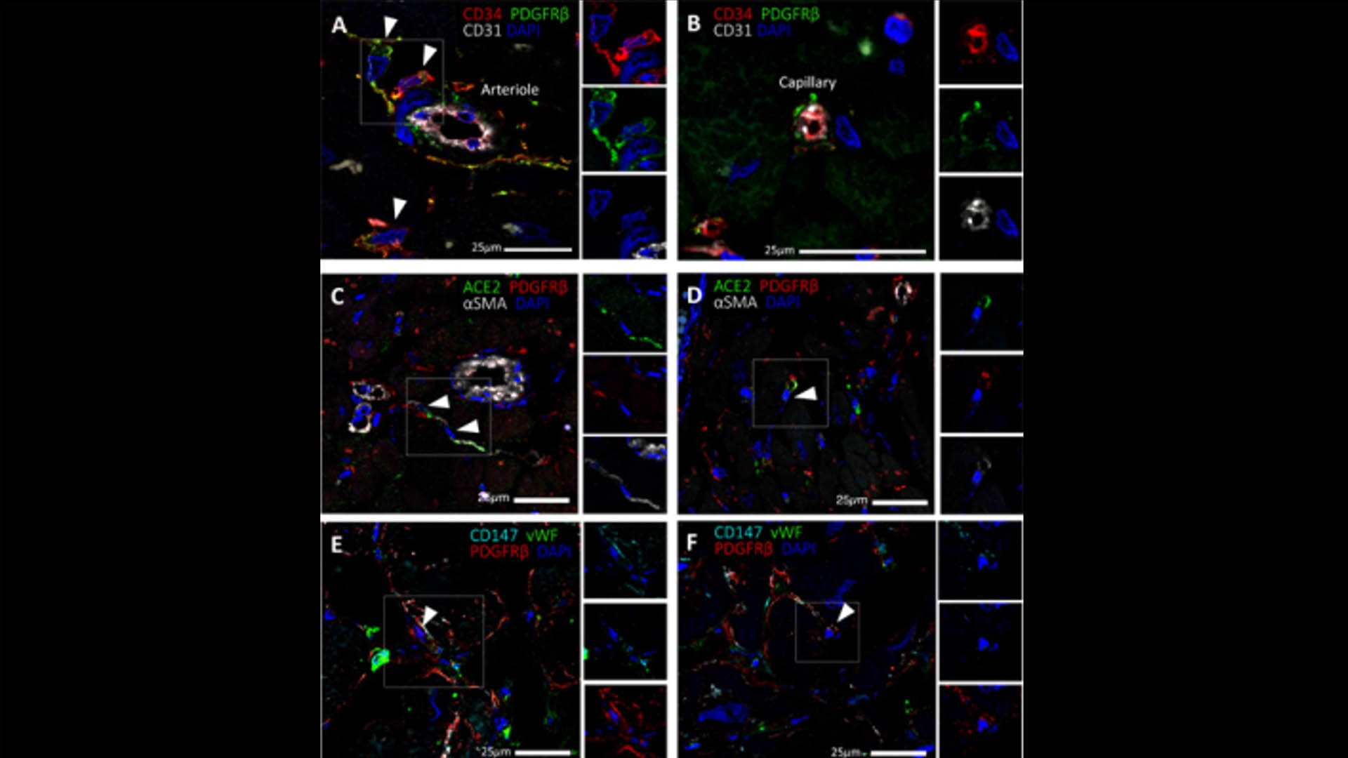 SARS-CoV-2 spike protein binds to heart’s vascular cells potentially ...
