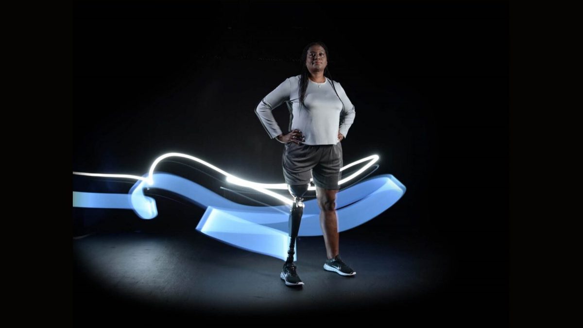 Össur introduces new motor-powered prosthetic knee - Healthcare Radius