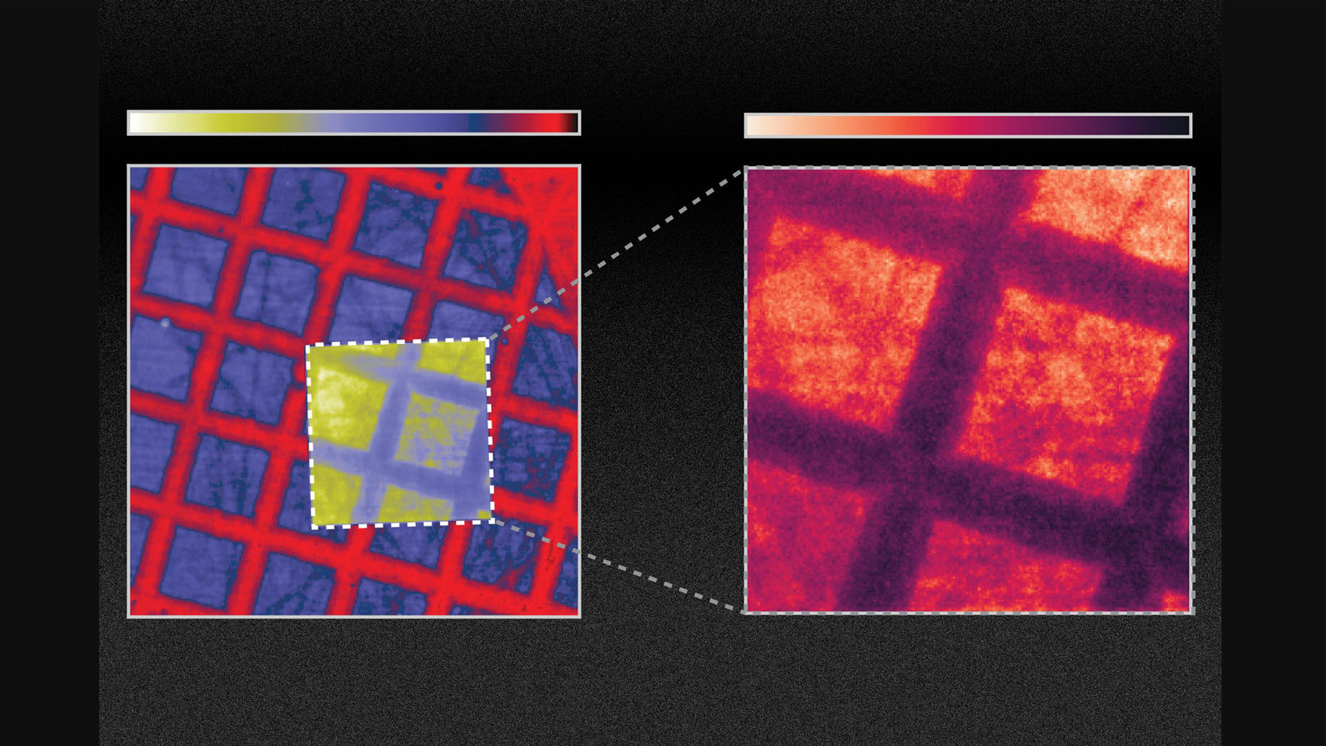 More sensitive X-ray imaging - Healthcare Radius More sensitive X-ray imaging - Healthcare Radius