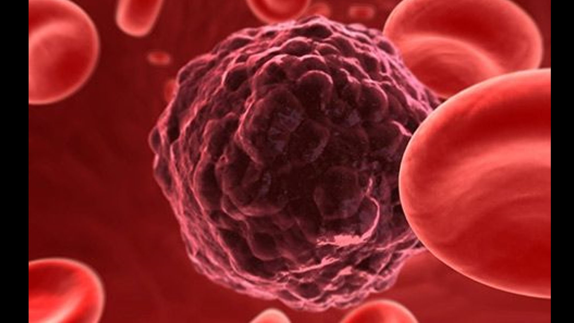 Prana Thoracic subsidiary to develop minimally invasive early lung ...