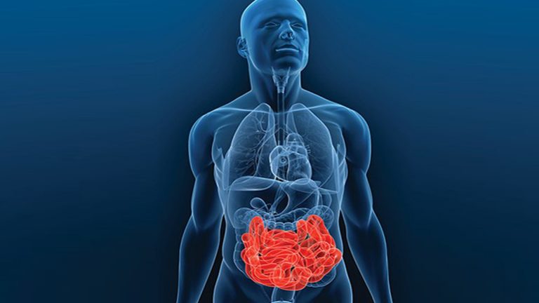 Global Hospital conducts first small bowel transplant in Mumbai ...