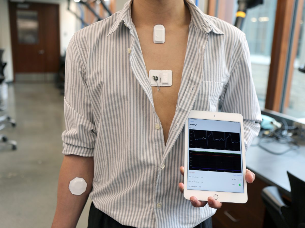 Smart, dissolving pacemaker communicates with body-area sensor and ...