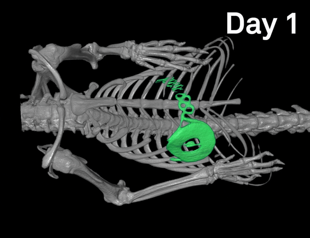 Smart, dissolving pacemaker communicates with body-area sensor and ...