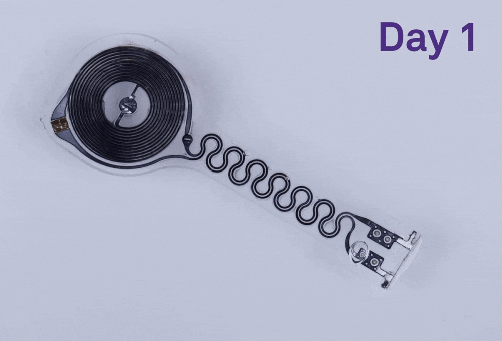 Smart, dissolving pacemaker communicates with body-area sensor and ...