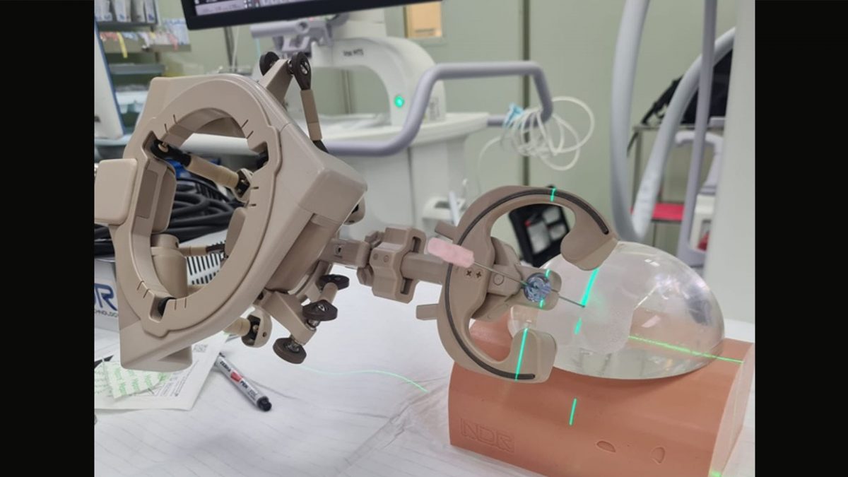 AI-enabled surgical robot for renal access in kidney stone surgery ...