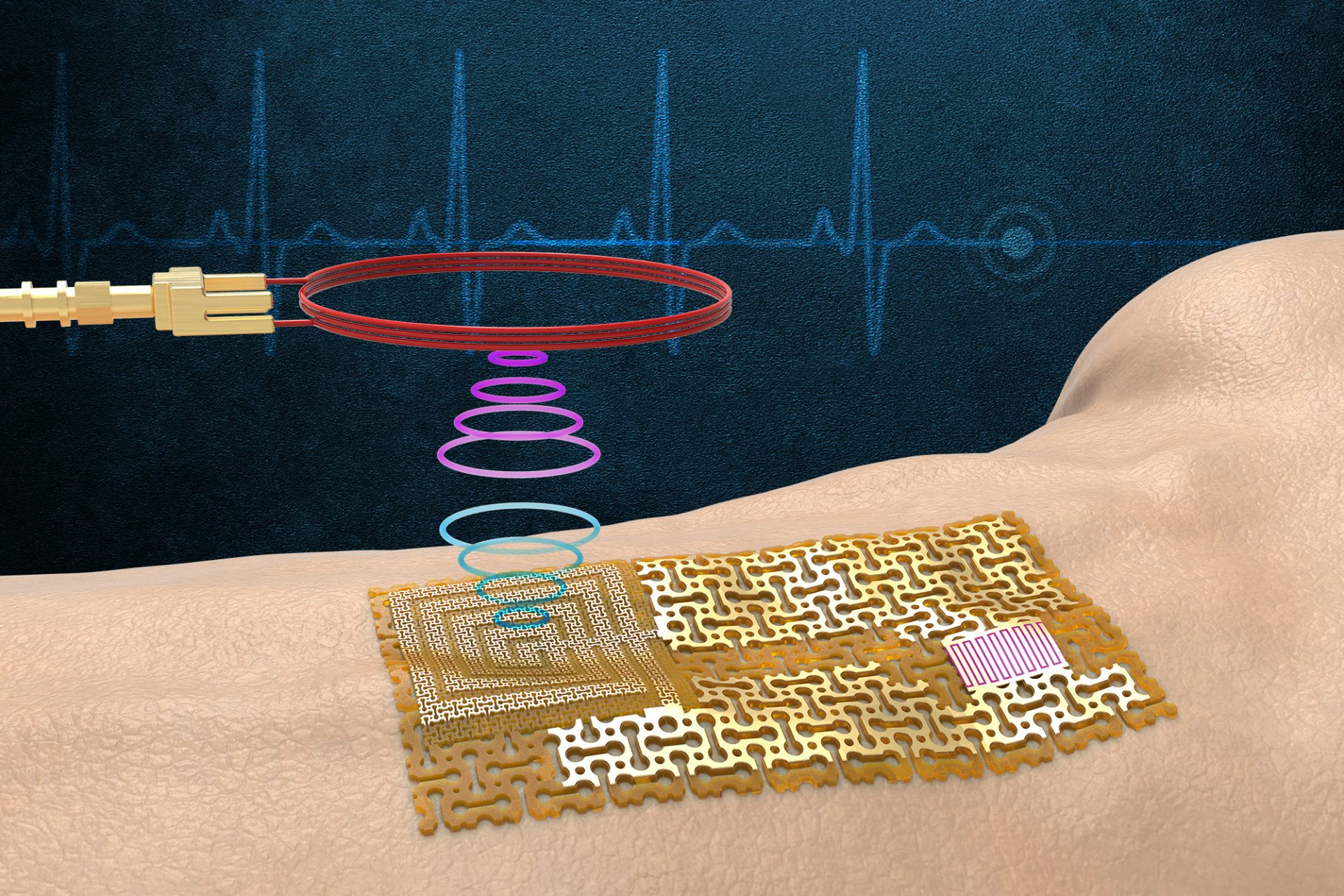 Engineers Fabricate A Chip Free Wireless Electronic ‘skin Healthcare Radius 