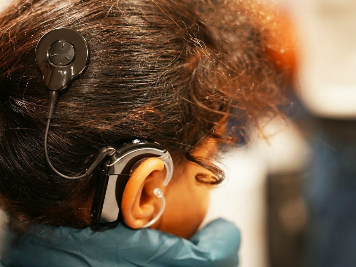 Sarvodaya Hospital performs India’s youngest cochlear implant on a 5 ...