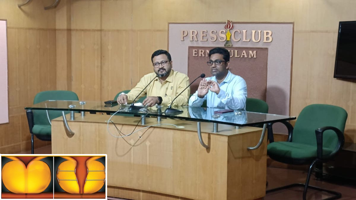 Aster Medcity performs prostatic Urolift procedure - Healthcare Radius