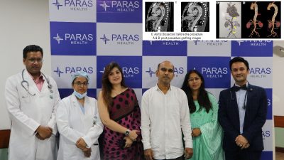 Aortic dissection patient saved with TEVAR at Paras Health - Healthcare ...