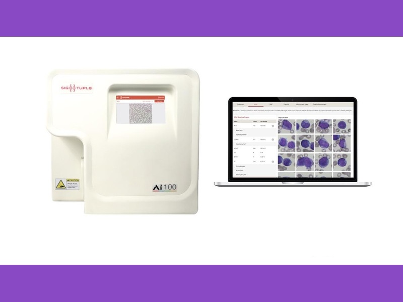 SigTuple AI100 with Shonit gets FDA clearance - Healthcare Radius