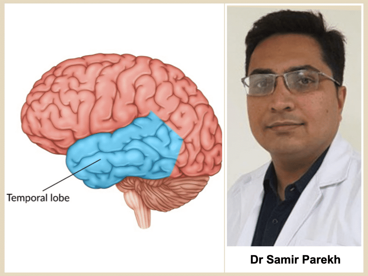 Brain surgery rescues epilepsy patient - Healthcare Radius