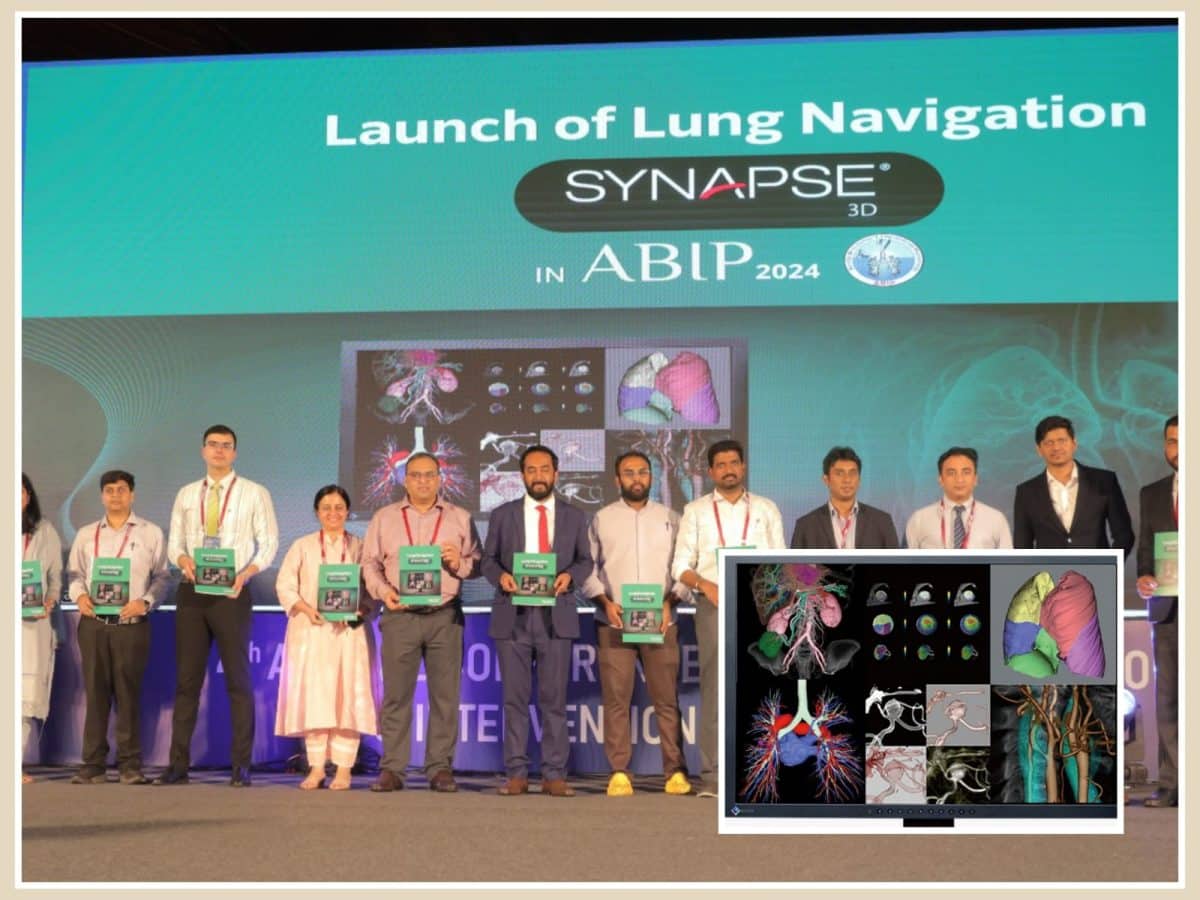 FUJIFILM unveils 3D lung navigation system - Healthcare Radius