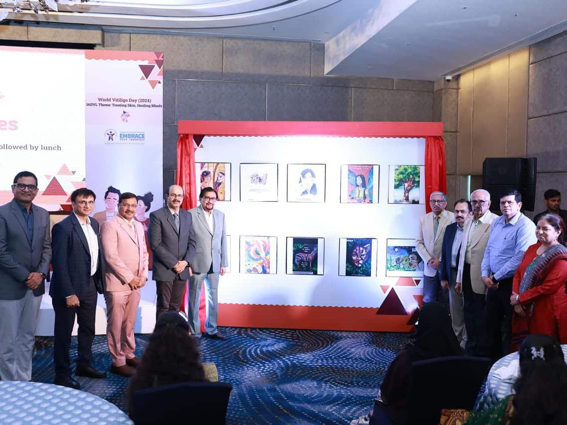 Glenmark, IADVL launch Vitiligo awareness campaign - Healthcare Radius