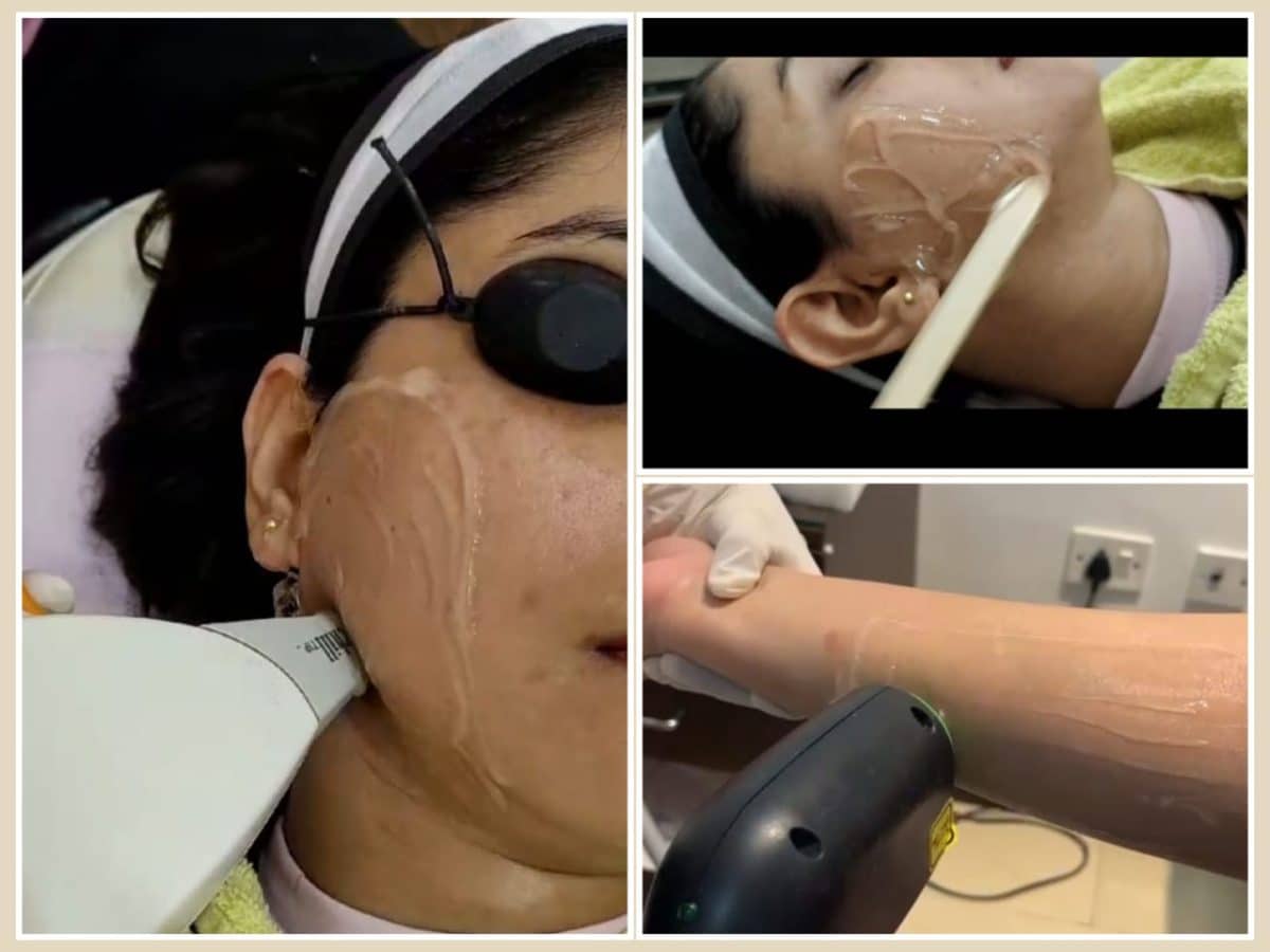 Sculpt Clinics offers fast laser hair removal - Healthcare Radius