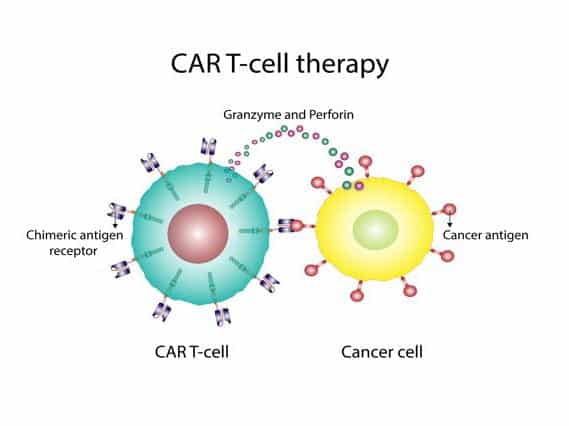 MOC Cancer Care & Research introduces CAR-T cell therapy - Healthcare ...