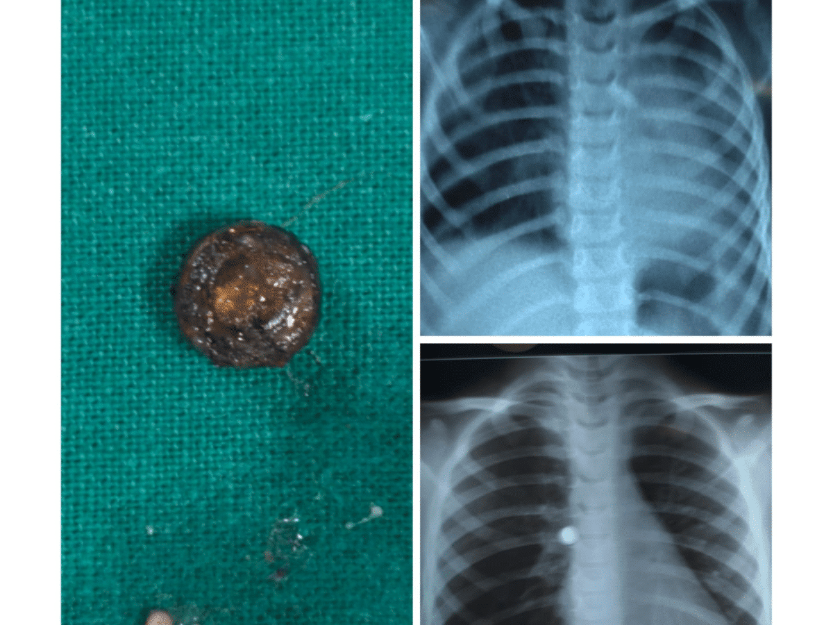 FUJIFILM unveils 3D lung navigation system - Healthcare Radius