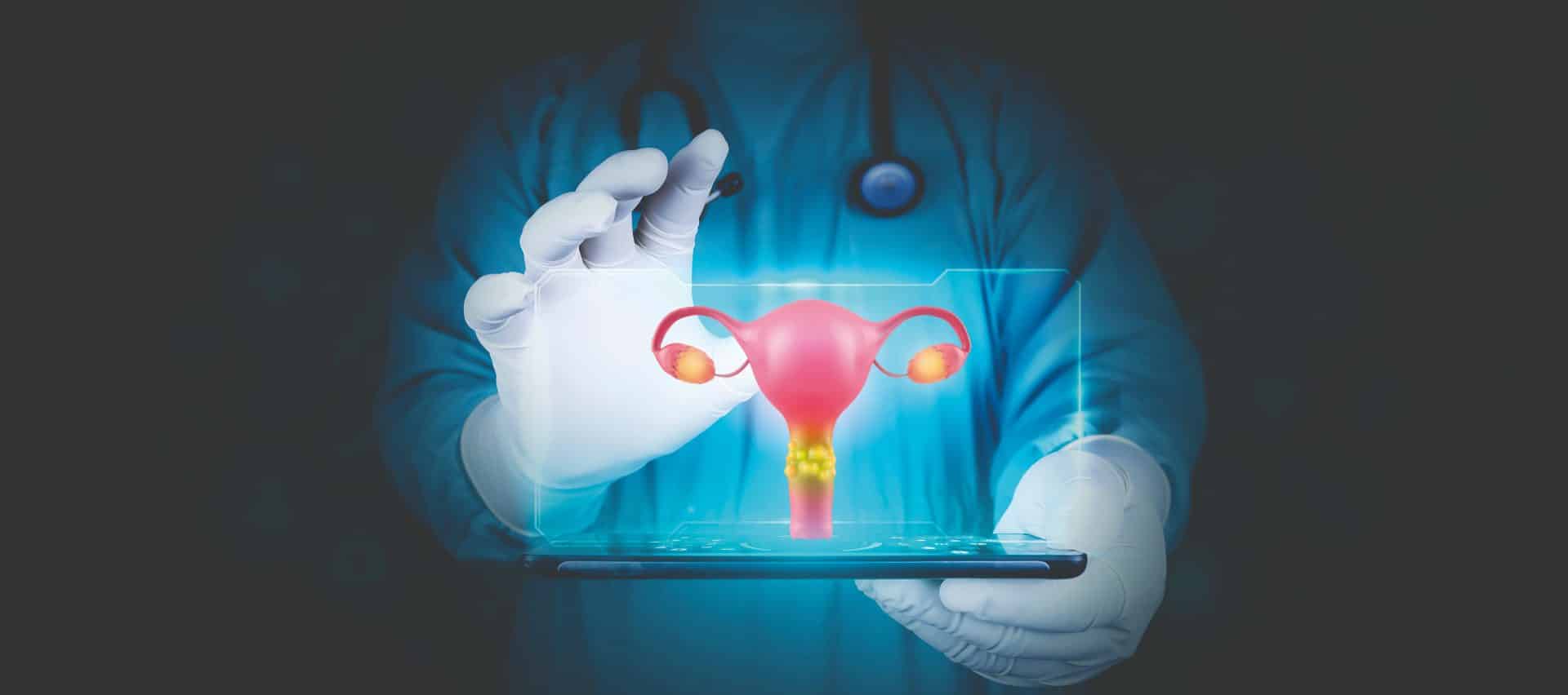 How is AI transforming early diagnosis of cervical cancer in India ...