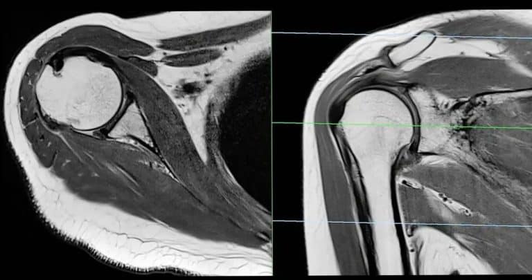 How latest MRI techniques are helping doctors spot soft tissue injuries ...