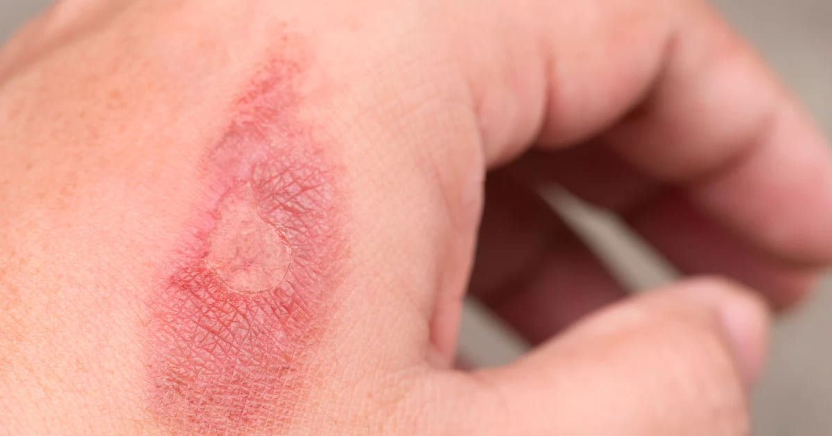 Skin science: Researchers reveal game-changing recipe