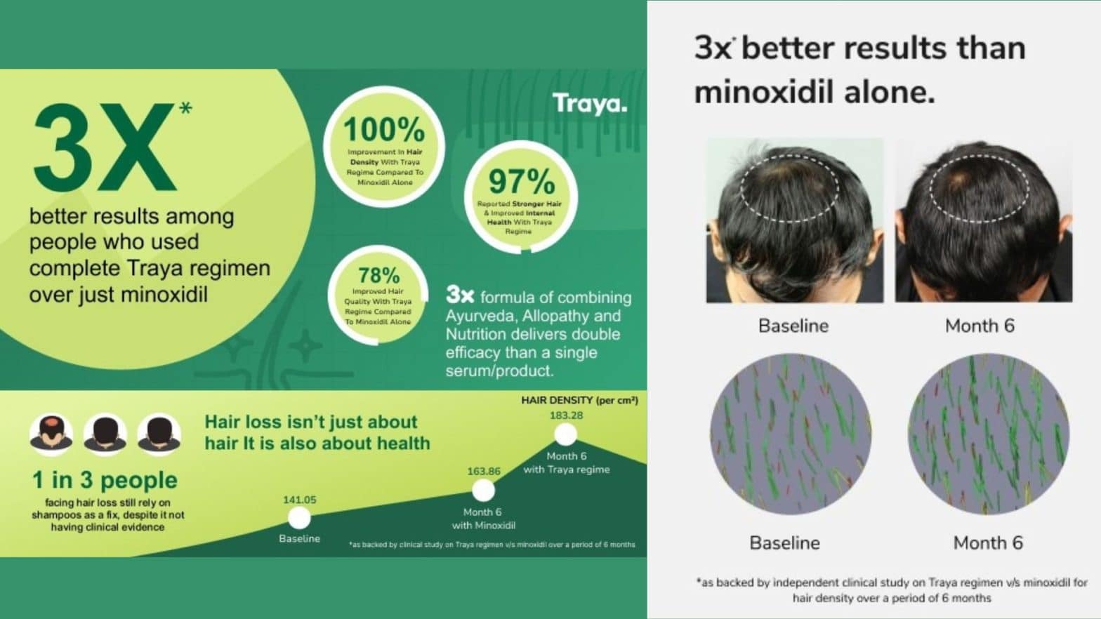 Eli Lilly launches Copellor for psoriasis treatment - Healthcare Radius