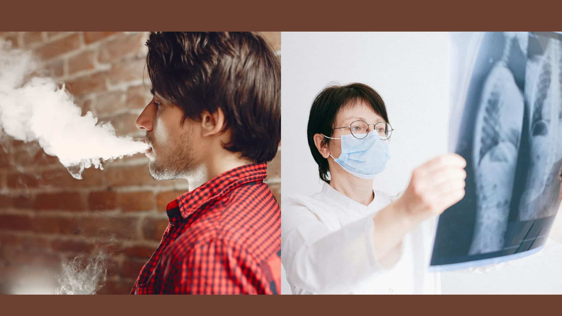 Lung cancer risk isn’t just for heavy smokers, says doctor