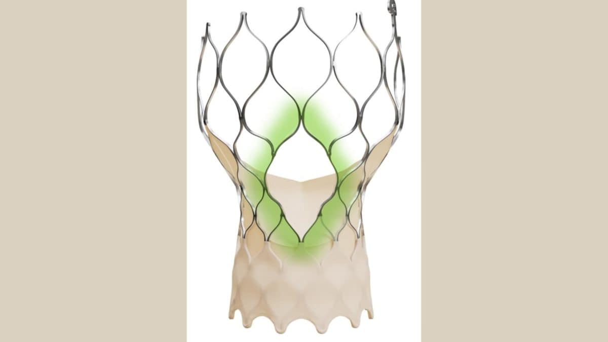 Medtronic launches Evolut FX+ heart valve in India