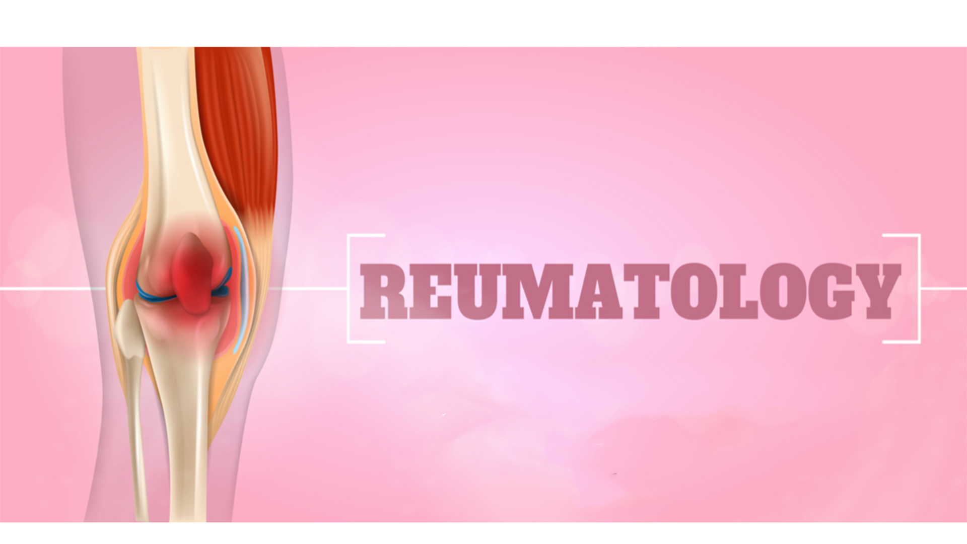 Managing Rheumatologic diseases - Features - Health Care Radius